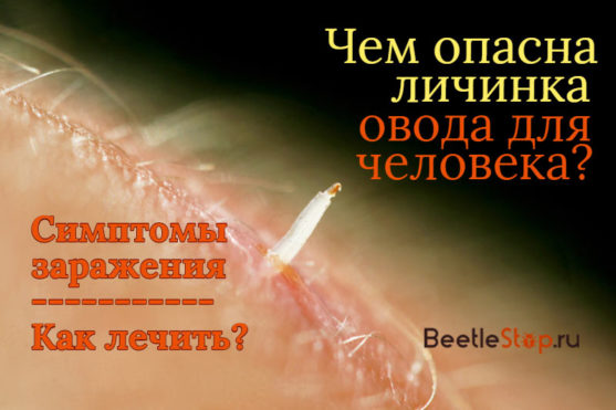 Gadfly larva in a person: where do they come from and how to get rid of ...